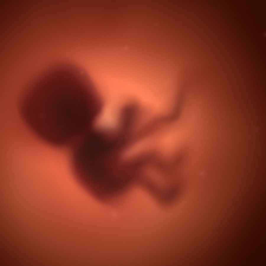 So What if a Fetus is Alive and Human? | Catholic Answers Q&A