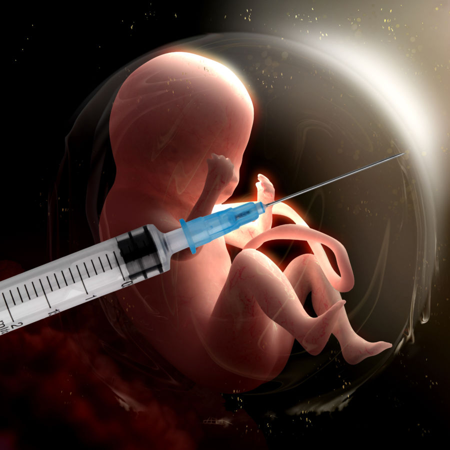 Counterpoint: We Should Reject Abortion-Tainted Vaccines | Catholic ...